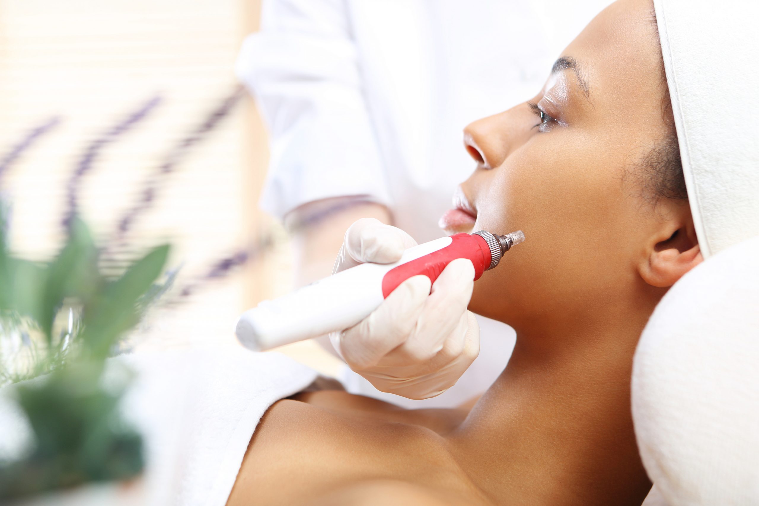 Microneedling Vs Chemical Peel Which Is Better CENTER For Advanced microneedling-vs-chemical-peel-which-is-better-center-for-advanced